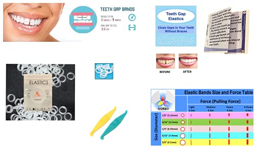 IVORIE® Dental Teeth Gap Orthodontic Bands Clear Elastic 100/Pk (1/4 ...